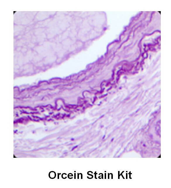 Orcein Stain Kit | HBsAg彈性纖維和銅相關蛋白的可視化染劑 貨號K1432 (ABCAM ab245881)
