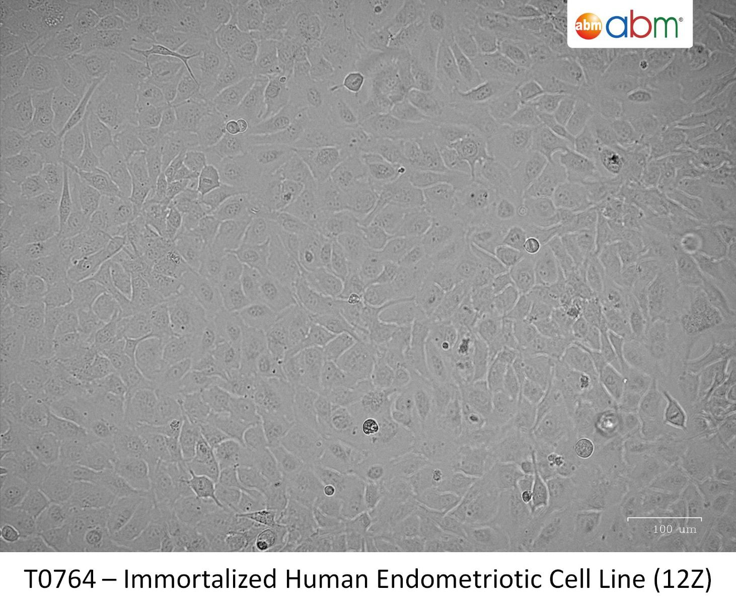 人子宮內膜異位細胞 | Immortalized Human Endometriotic Cell Line (12Z) 貨號T0764